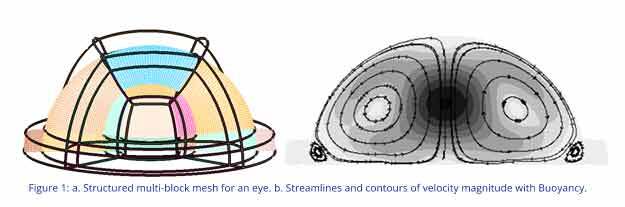 Transforming Human Eye CFD with GridPro Meshing Software | GridPro